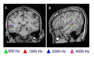 Auditory cortex: physiology – Voyage au centre de l'audition