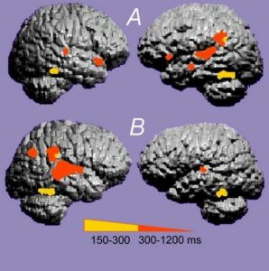 Auditory cortex: physiology – Voyage au centre de l'audition